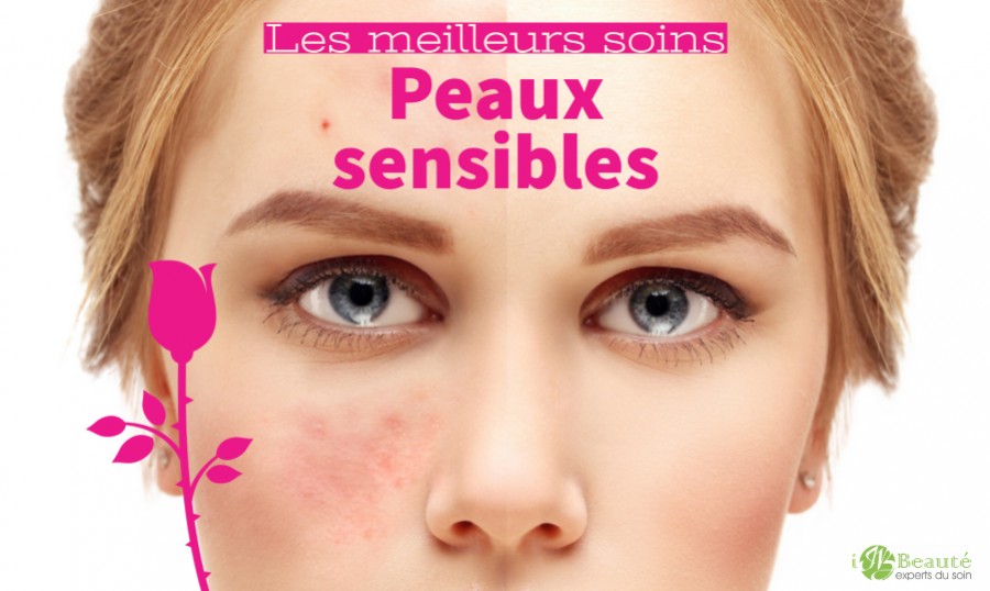 Les meilleurs soins anti-rougeurs : couperose, rosacée ou peau sensible